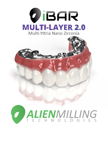 Alien iBar Multi-Layer 2.0 - Full Arch Zirconia with Titanium Bar ...