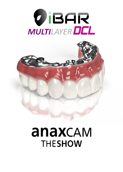 Alien iBar with AnaxCAM The Show Multi-Layer CDL - Full Arch Long Term ...