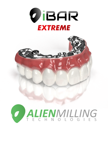 Alien iBar Extreme - Full Arch Zirconia with Titanium Bar Support ...
