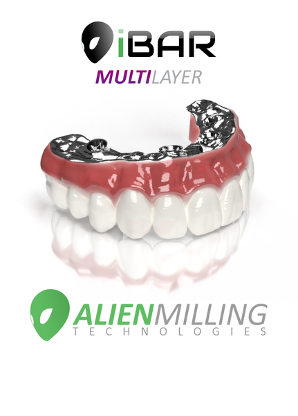 Alien iBar Multi-Layer - Full Arch Zirconia with Titanium Bar Support ...